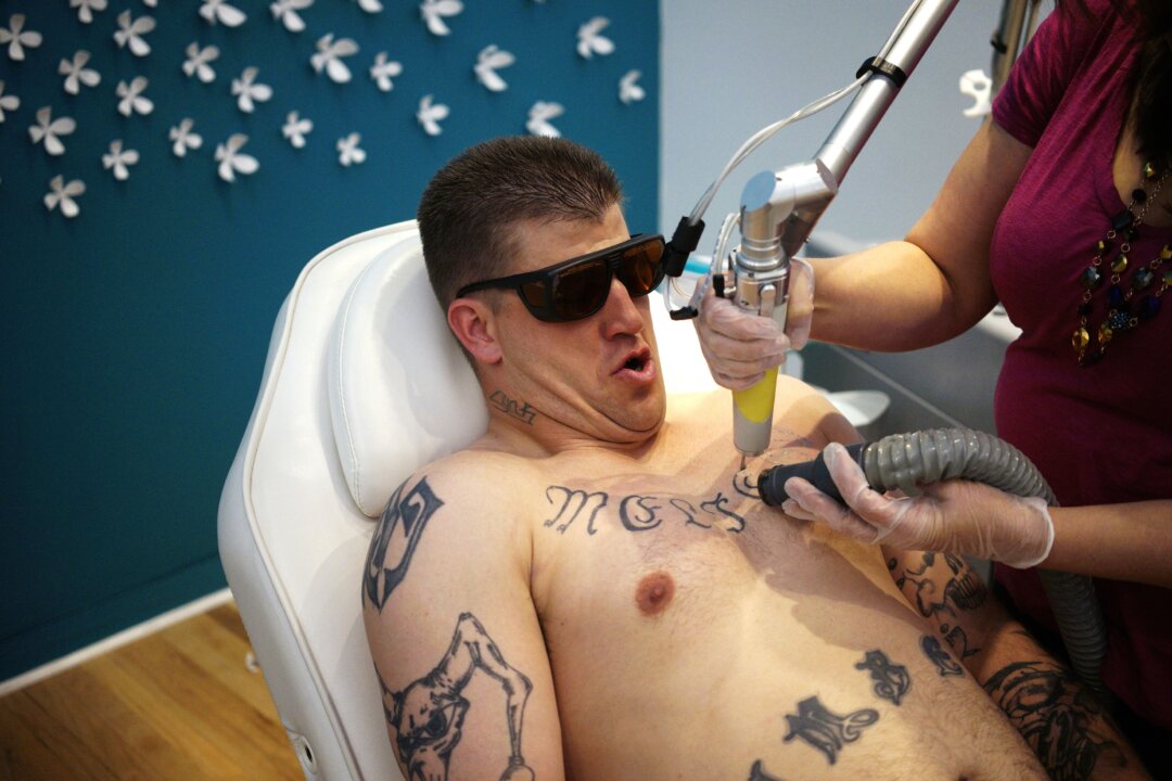 Bad Ink: Tattoo Removal a Burgeoning Industry | The Epoch Times
