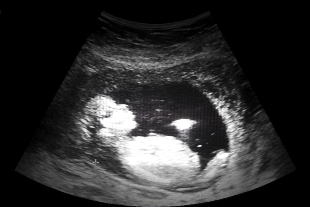 Pre-Birth Memories: Can People Remember Being in the Womb? Being Born ...