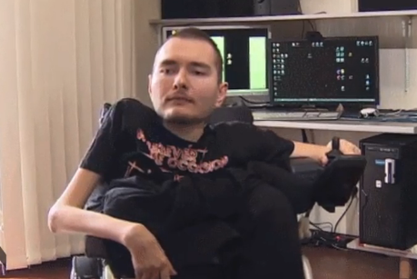 First Ever Head Transplant Surgery Set for 2017 (Video) | The Epoch Times