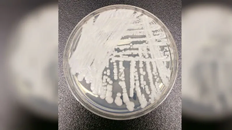 Oregon Hospital System Reports Outbreak of Rare Fungal Superbug