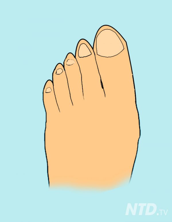 Here Are 13 Types of Toes and the Fascinating Clues They Reveal About ...