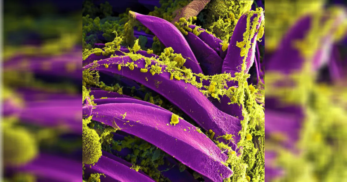 Two People Diagnosed With Pneumonic Plague in China