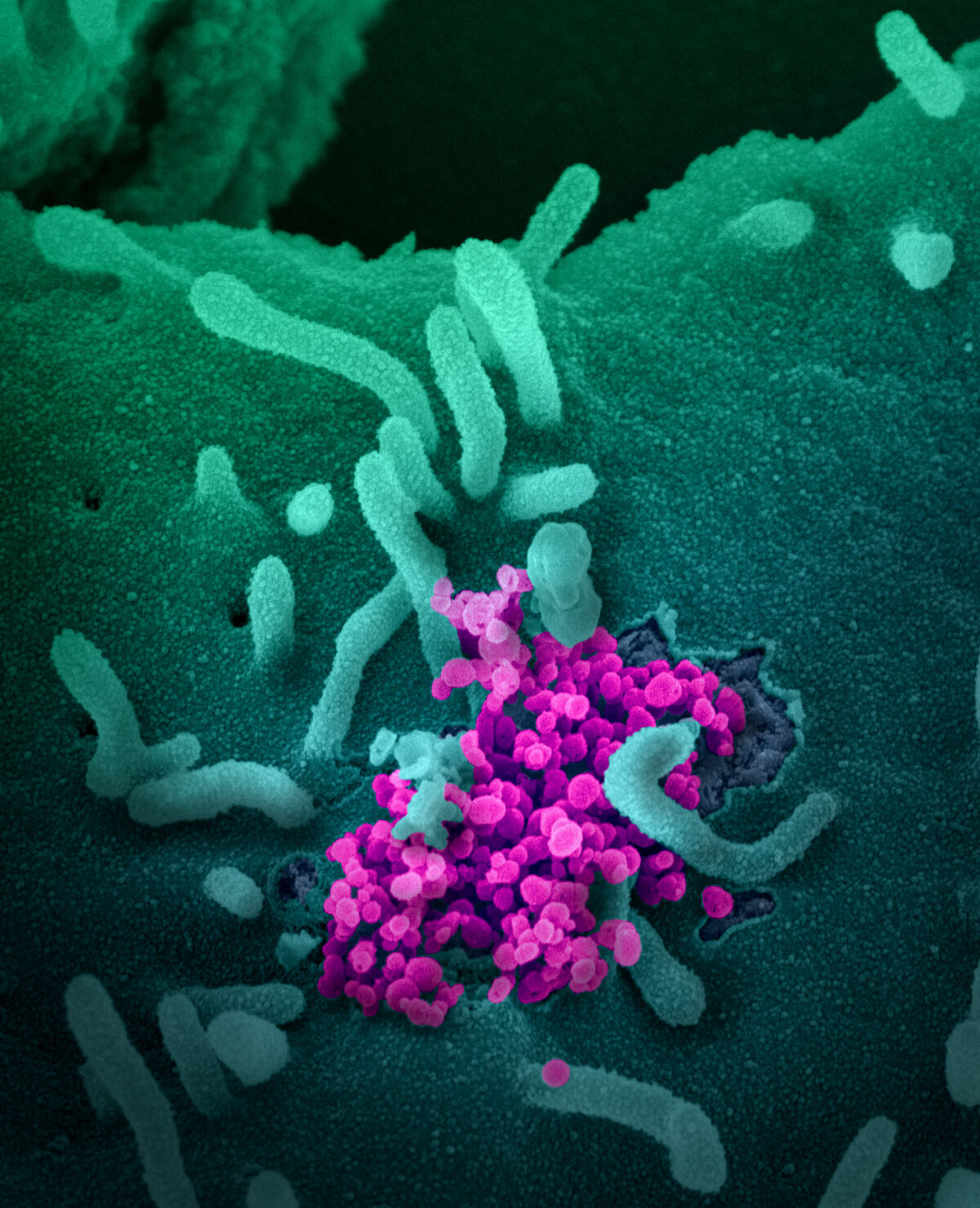 FDA Authorizes First At Home CCP Virus Test