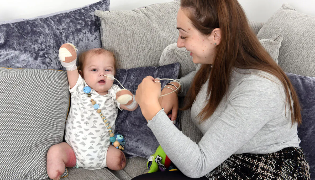 Mom Warns Parents After Baby Loses All Limbs to a Hard-to-Spot Sepsis ...