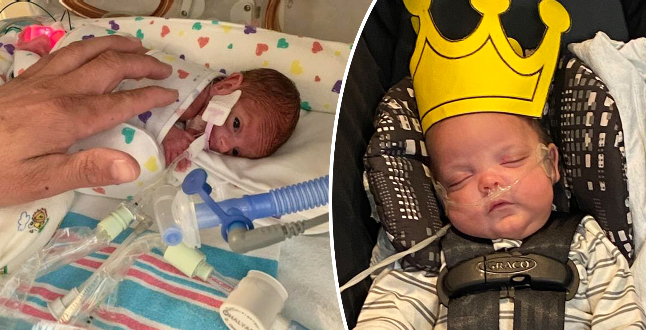 One-Pound ‘Micro-Preemie’ Born at 22 Weeks Goes Home After 133 Days in NICU