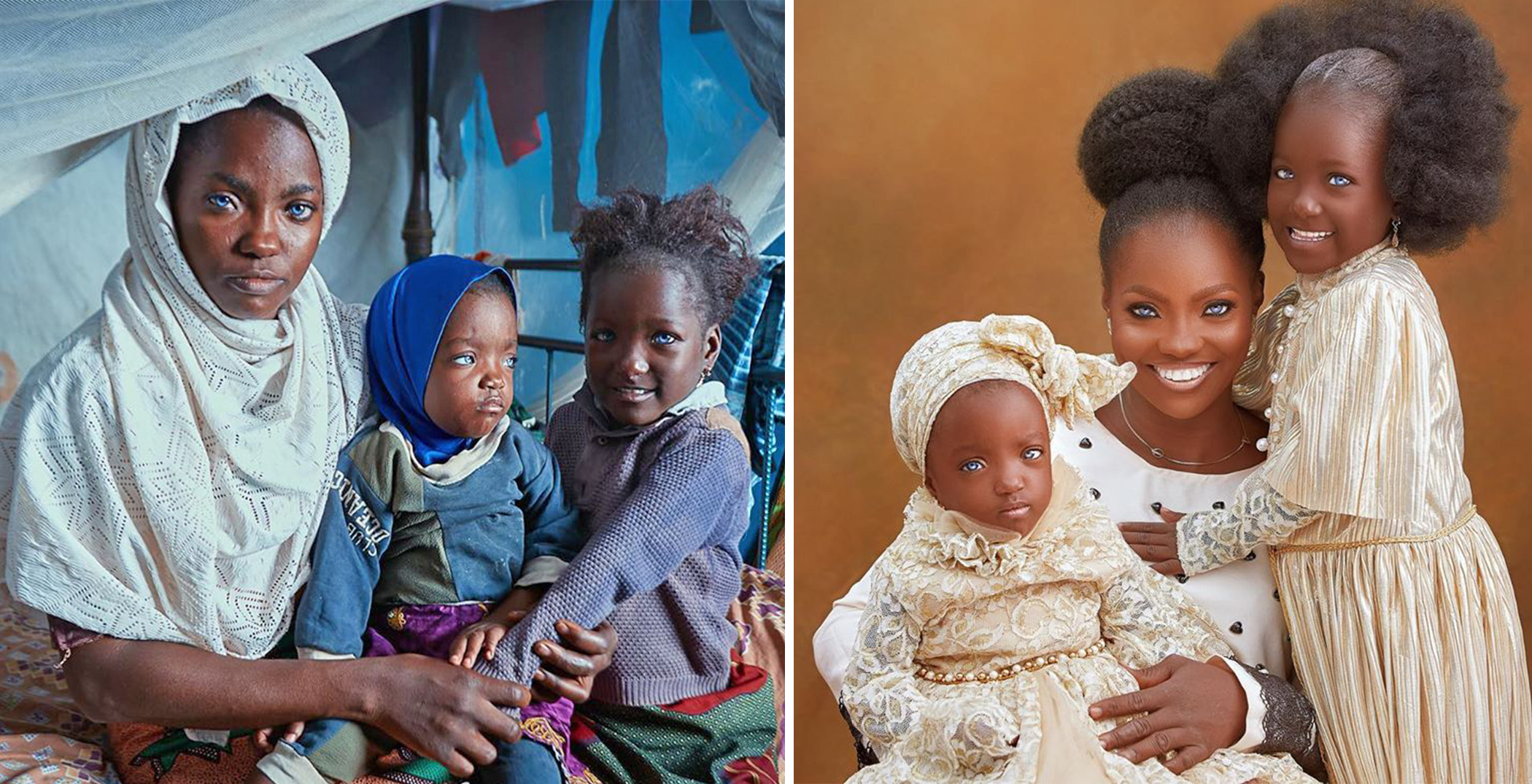 ‘Rare Blue-Eyed’ Mother, Kids Shunned by Husband Transform in Stunning ...