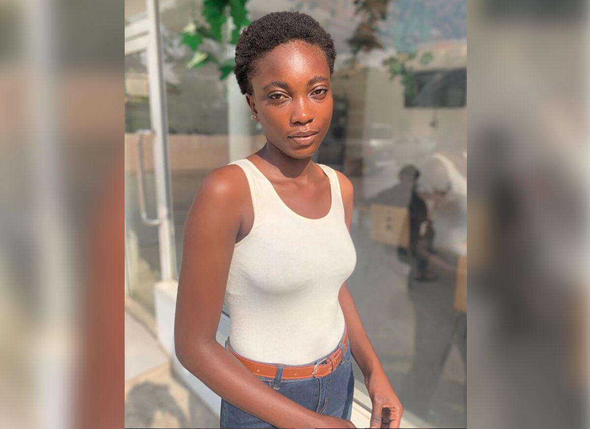 Model With an ‘Imperfect’ Smile Inspires People to Love Themselves and ...