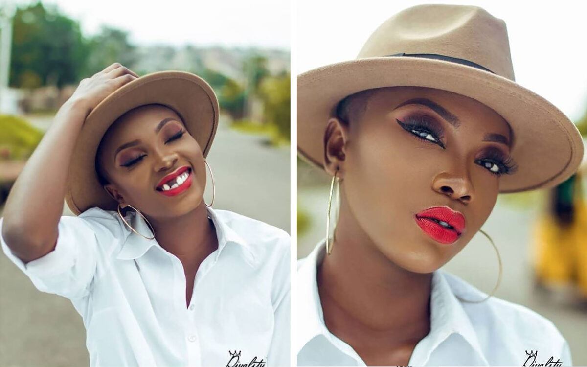 Model With an ‘Imperfect’ Smile Inspires People to Love Themselves and ...