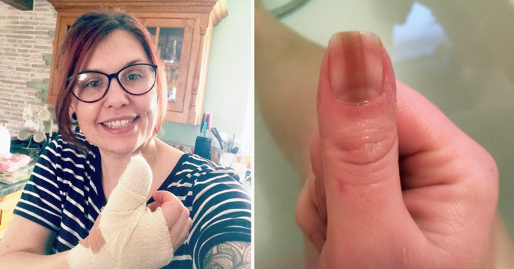 Woman Discovers Deadly Cancer After Reading an Article of a Tiny Line ...