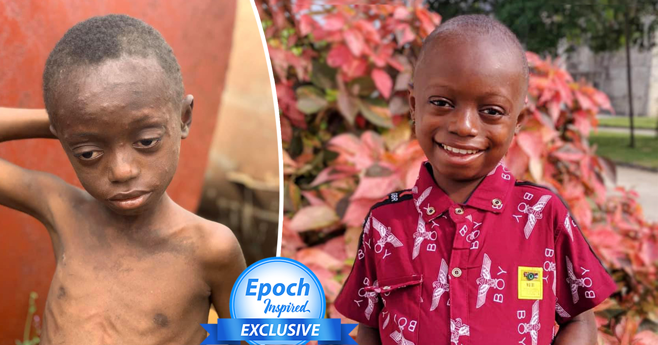Severely Beaten and Left Alone to Die, Boy Becomes ‘Happiest Child ...