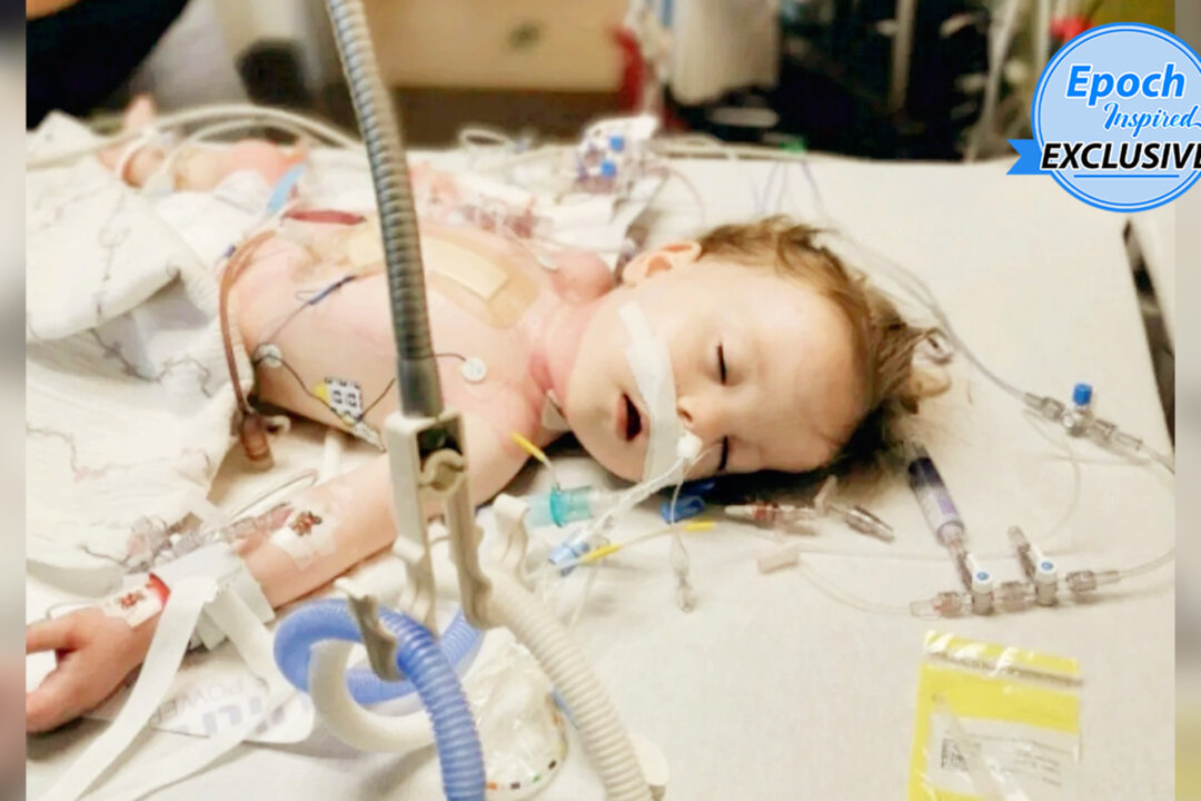 Baby Born With a Rare Birth Defect and Heart Condition Lives Happy Life ...