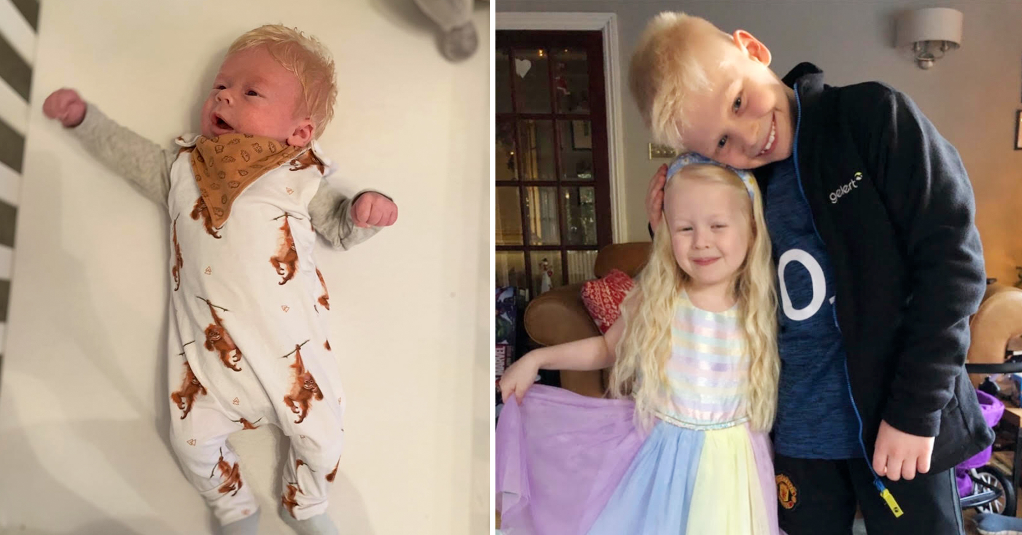 Baby Born With a Mop of Pure White ‘Snow-Like’ Hair ﻿Follows in ...