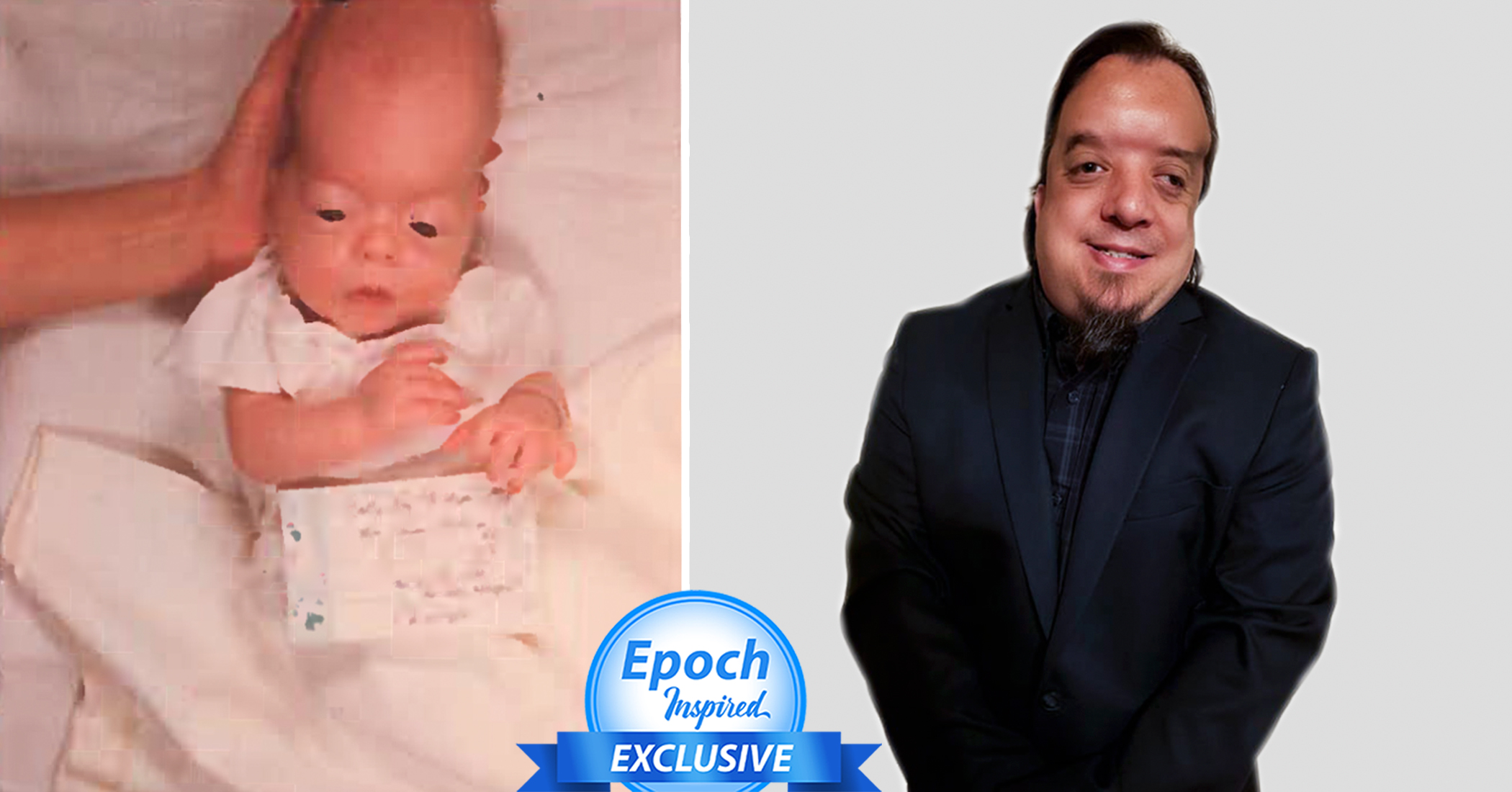 ‘God Created a Brain in My Head’: Boy Born Without a Brain Gets Healed ...