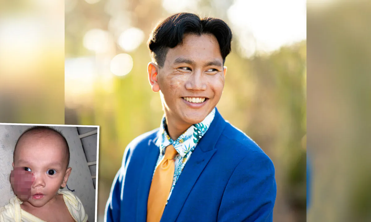 Vietnamese Baby With Facial Tumor Gets Adopted in the US, Reunites With ...