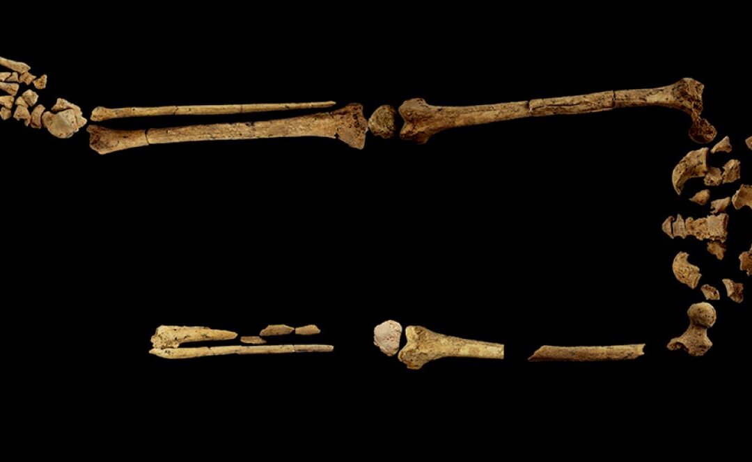 Earliest Known Case of Surgical Amputation Discovered | The Epoch Times