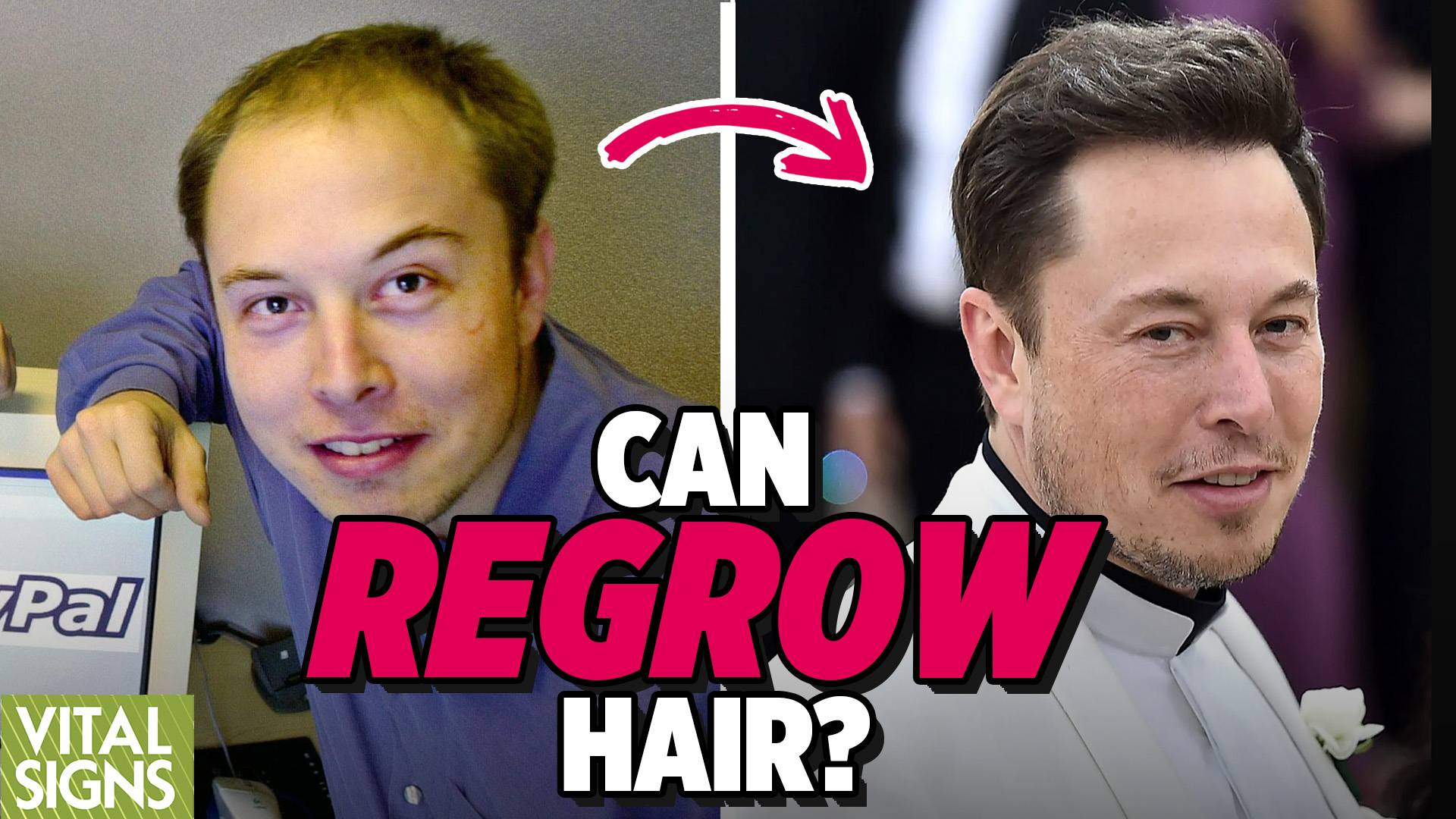 Losing Hair? Going Bald? Can it Really be Stopped?–Natural and Medical ...