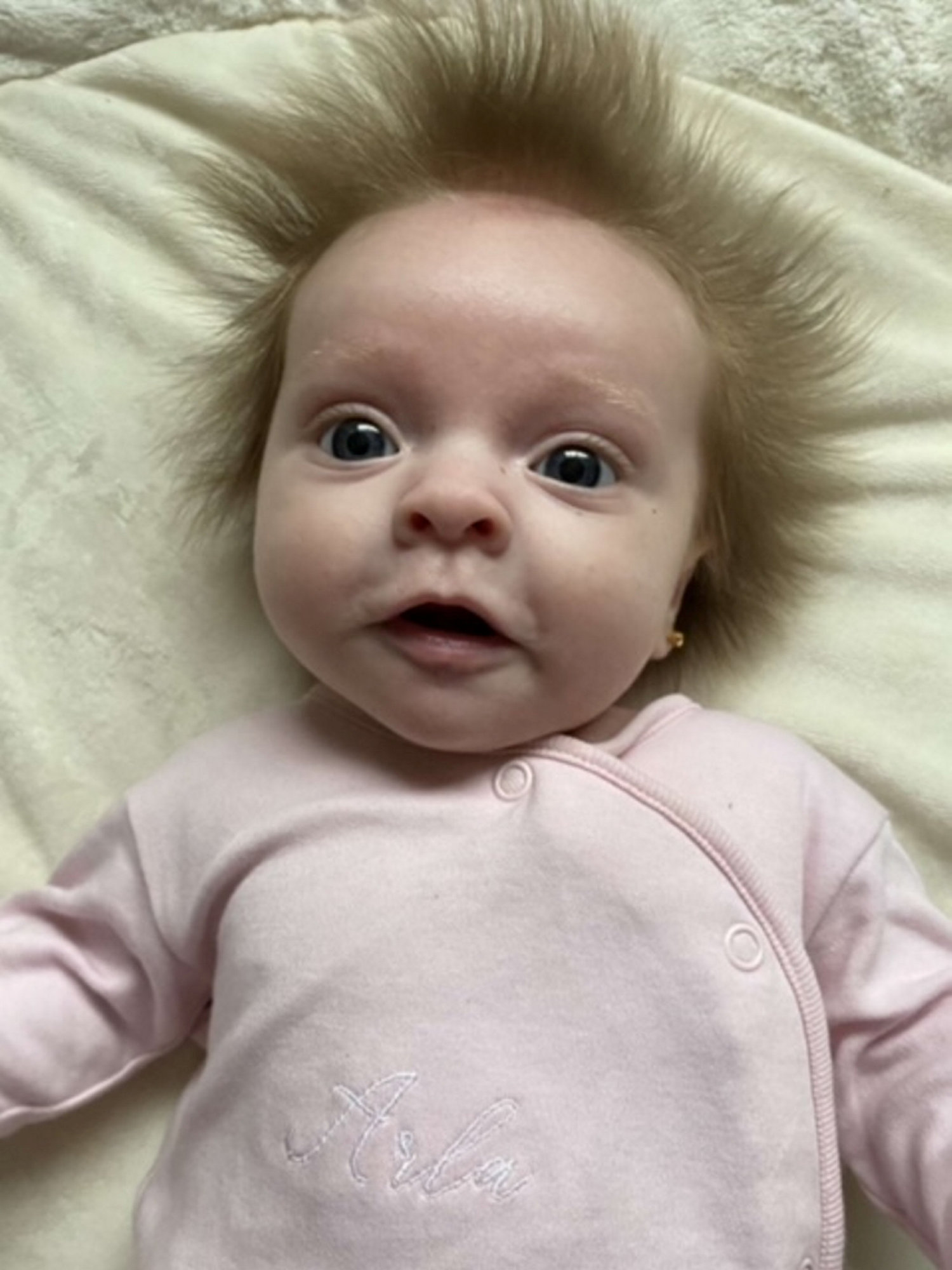 ‘It Just Doesn’t Stay Down’: Baby Is Born With Hair That Sticks Out in ...