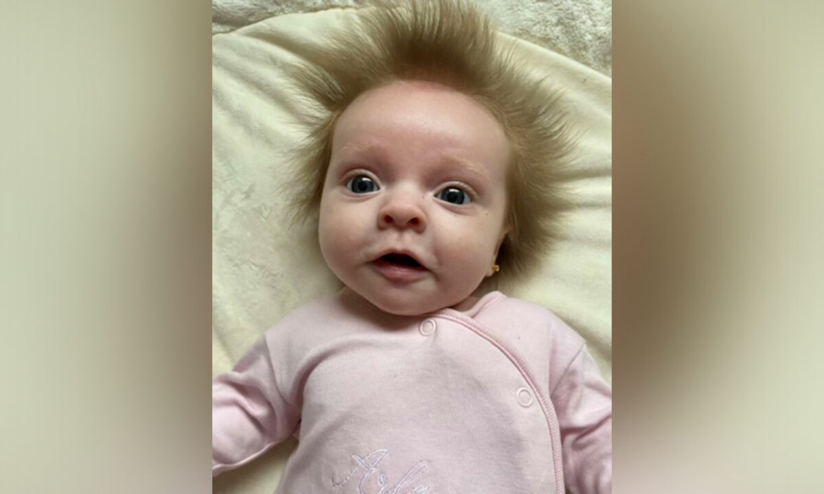 ‘It Just Doesn’t Stay Down’: Baby Is Born With Hair That Sticks Out in ...