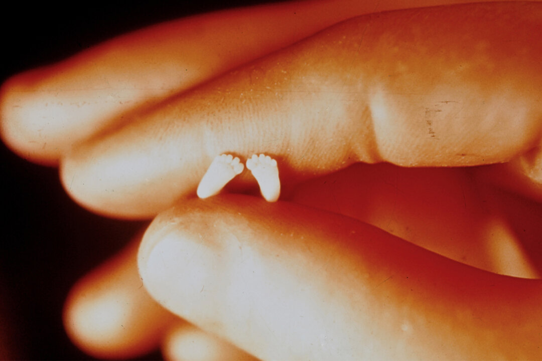 ‘Precious Feet’: Doctor’s Iconic Photo of a 10-Week-Old ‘Fetus’ Proves ...