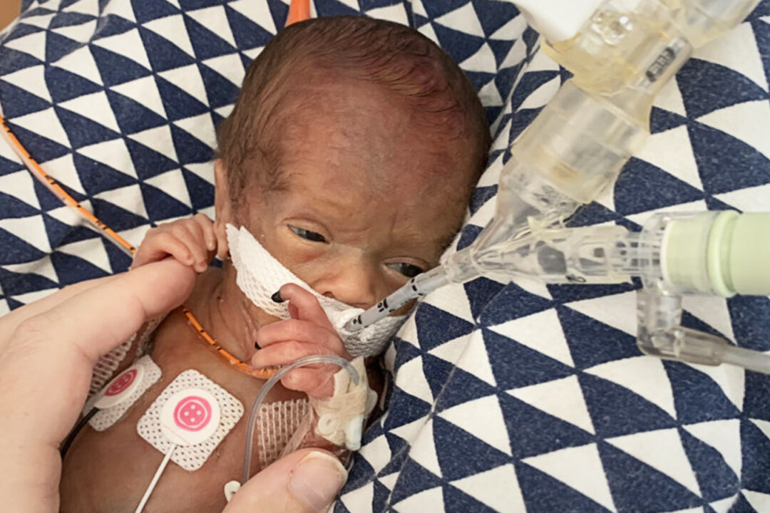Preemie Who Looked Like a Tiny Doll at Birth Turns 2—Here’s How This ...