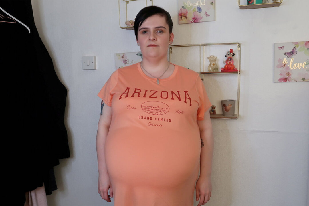 Woman With 15.7-Inch Stomach Cyst Left People Thinking She Was Pregnant ...