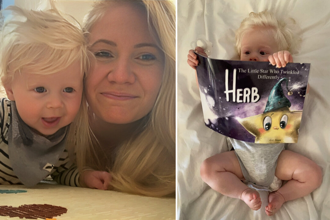 Mom of Boy Born With Snow White Hair and Visual Disability Becomes ...