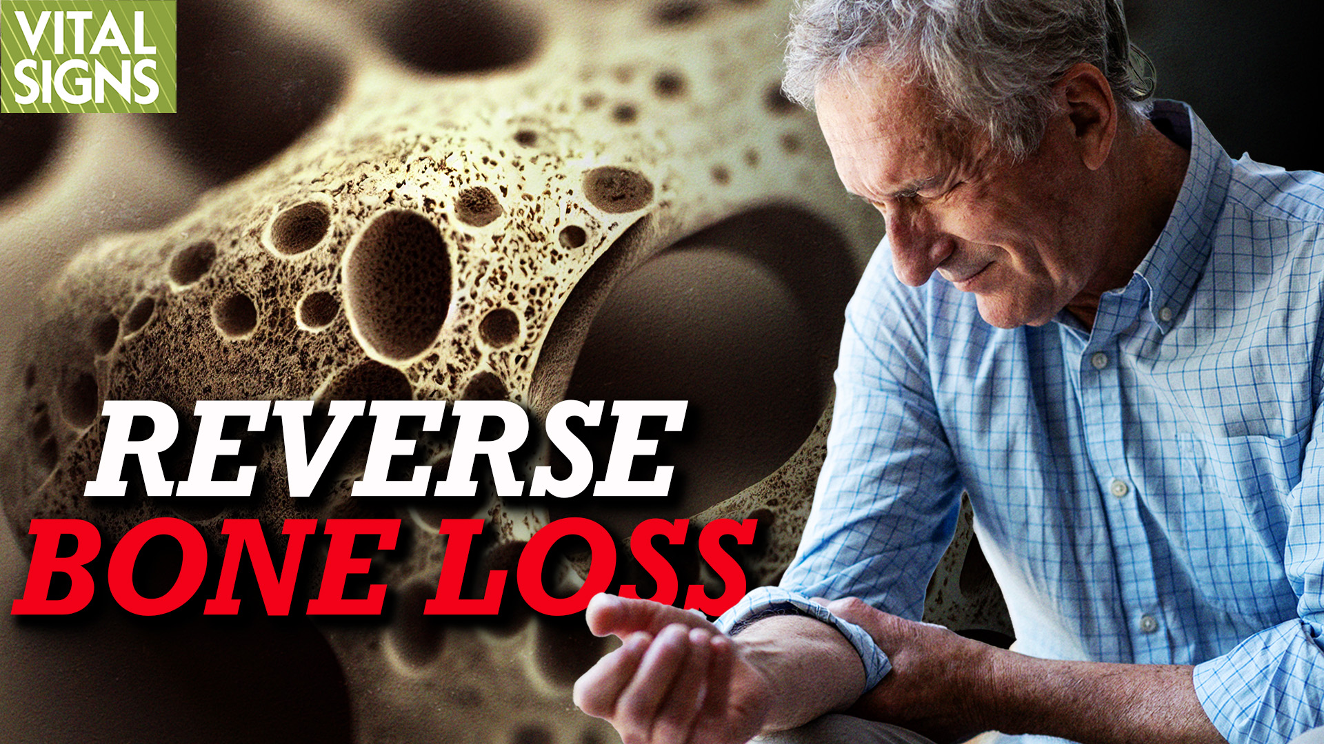 Curb Osteoporosis—Medication, Micronutrients, Exercise, and Foods for ...