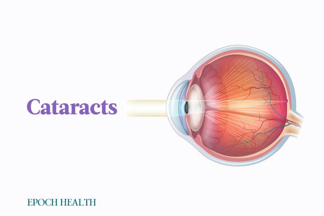 Cataracts: Symptoms, Causes, Treatments, and Natural Approaches | The ...