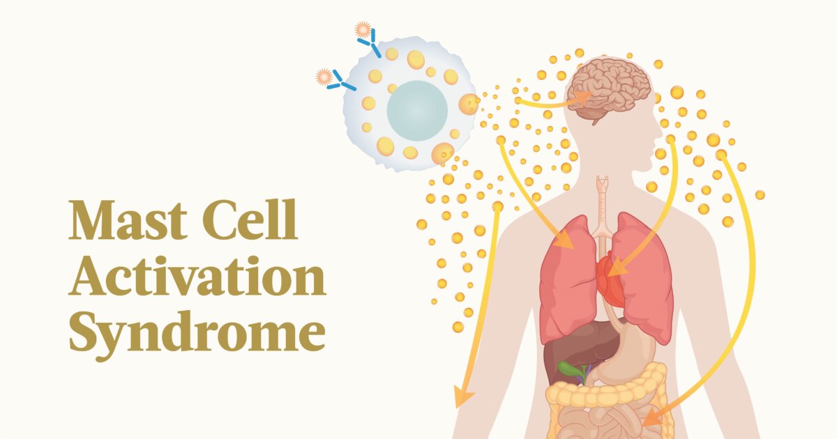 Mast Cell Activation Syndrome Causes – MSBA
