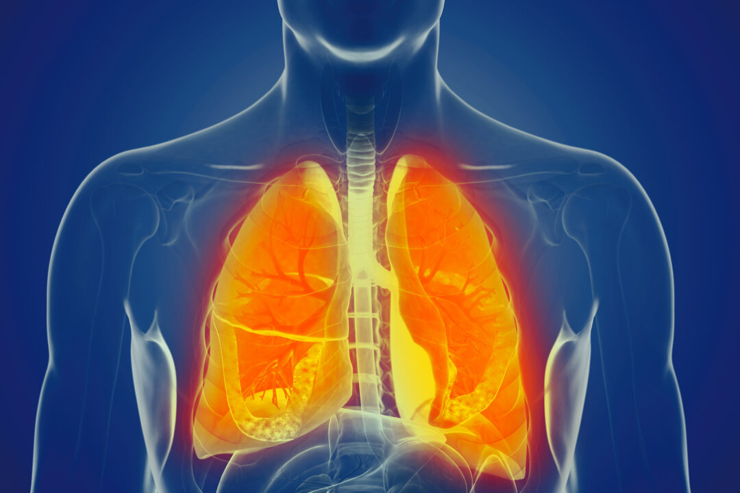 Poor Oral Health Speeds Up Irreversible Lung Disease: Study | The Epoch ...
