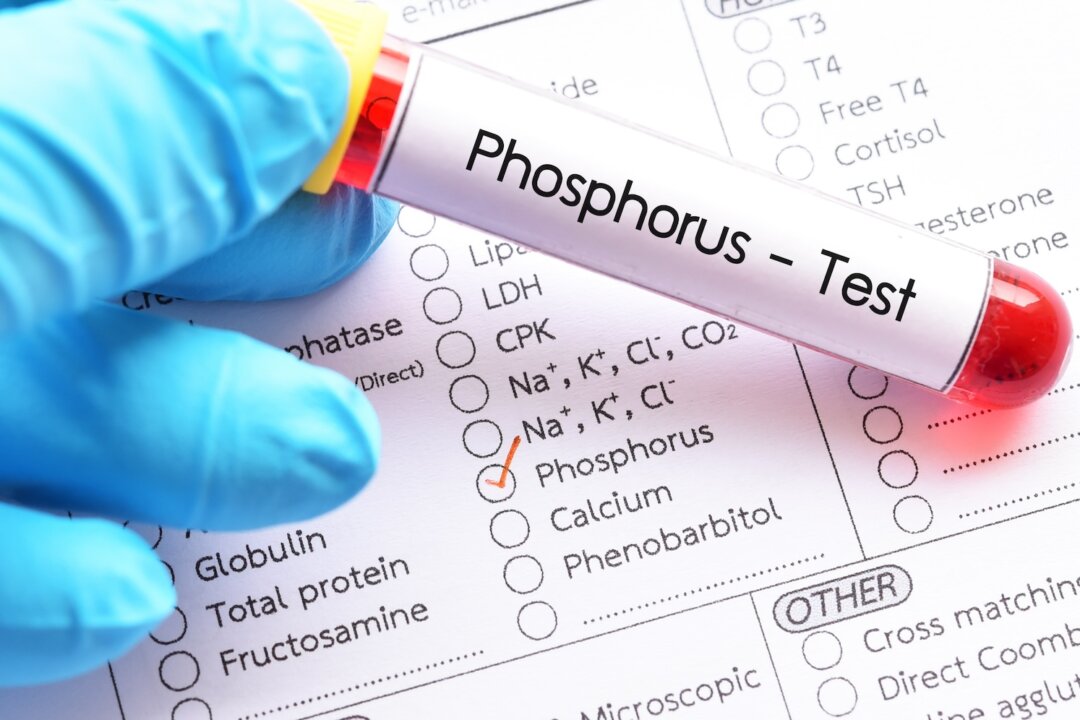 Excessive Phosphorus in Food and Medicine: A Growing Concern | The ...