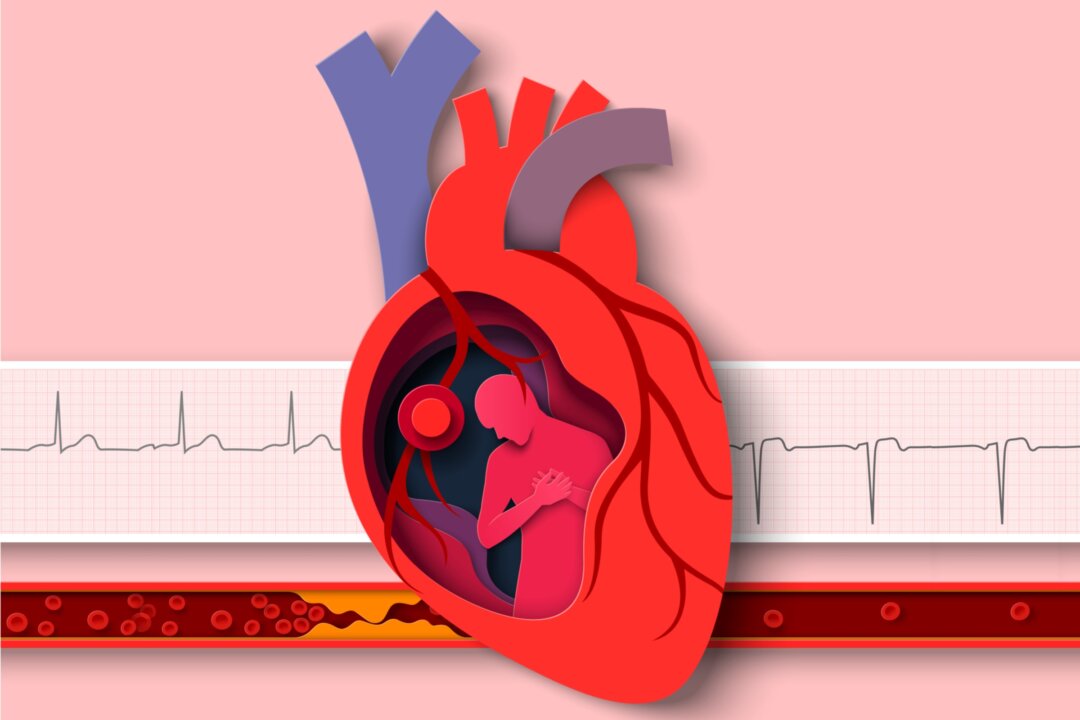 Motivation Improves Recovery From Heart Attacks: Study | The Epoch Times