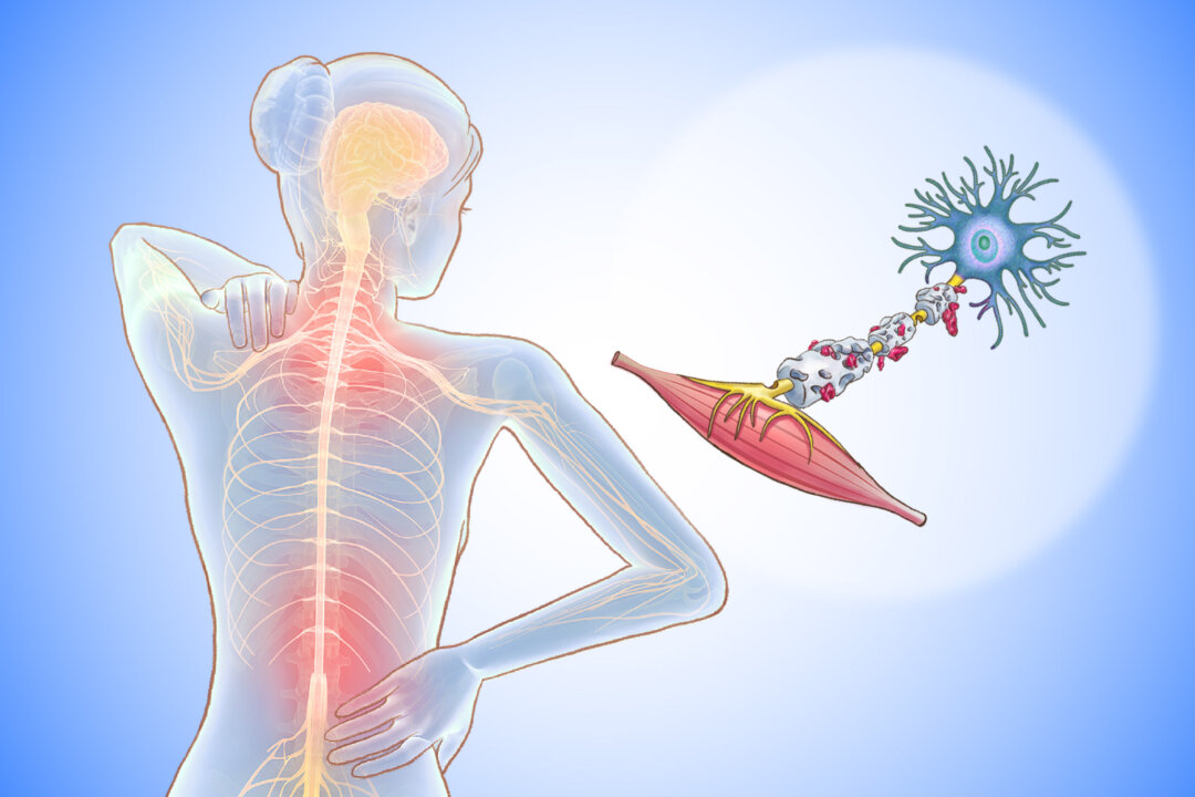 Multiple Sclerosis: A Debilitating Autoimmune Disease and Its Early ...