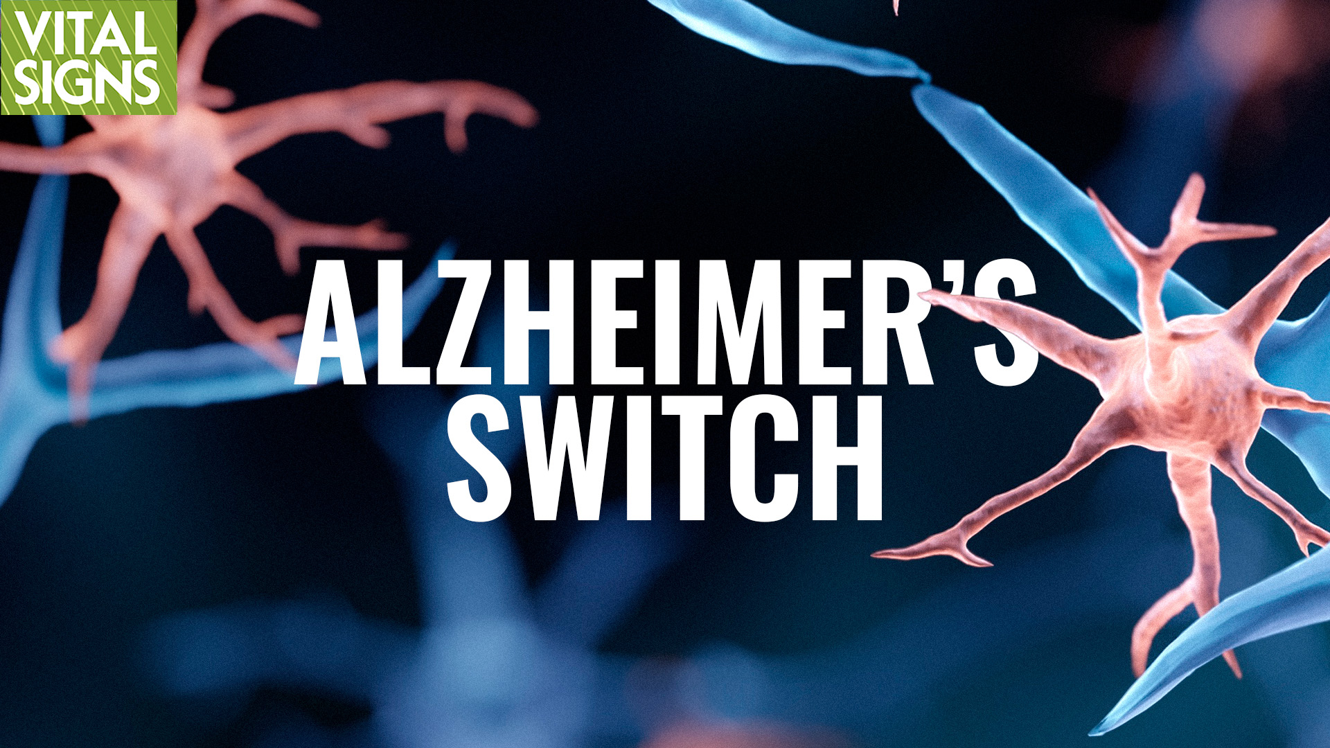 Shift Immune Cells From Attack to Brain-Defense Mode | David Perlmutter ...