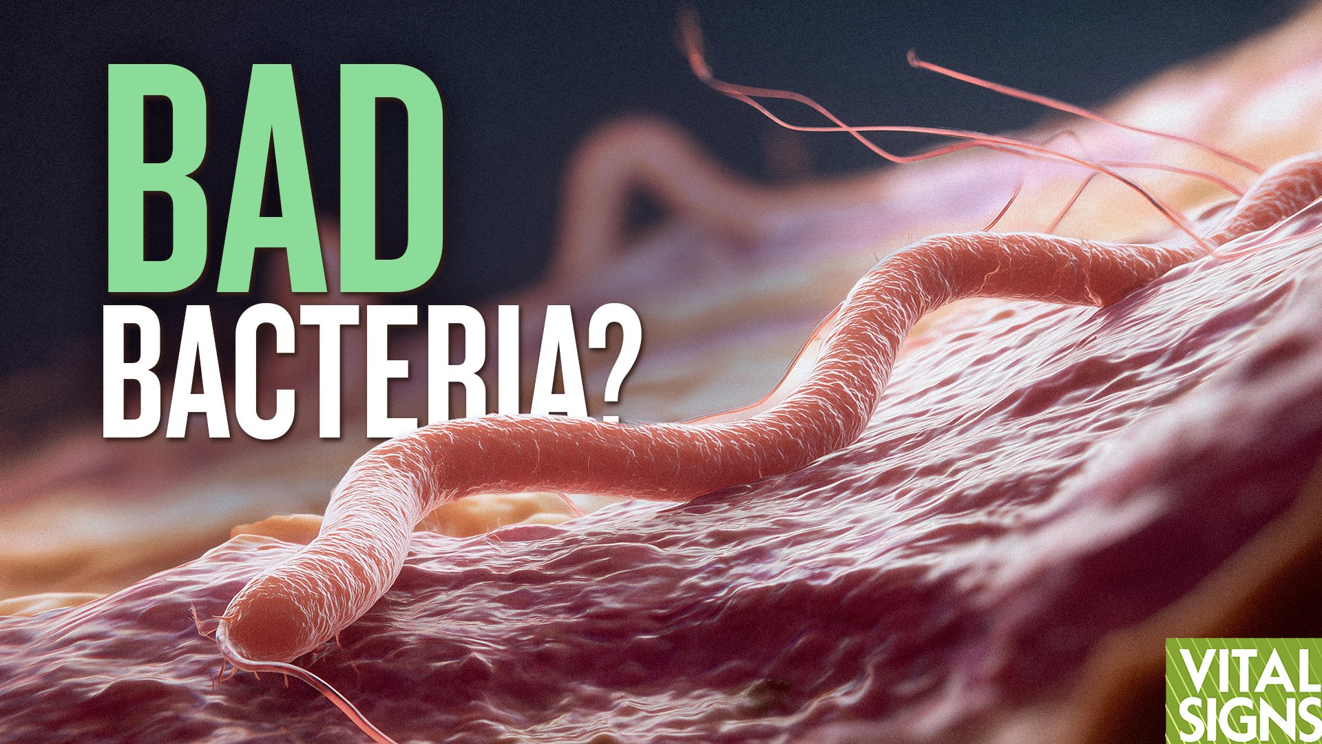 Fix the Gut Cause of Vaginal Infection, Bloating, IBS | Adeeti Gupta MD ...